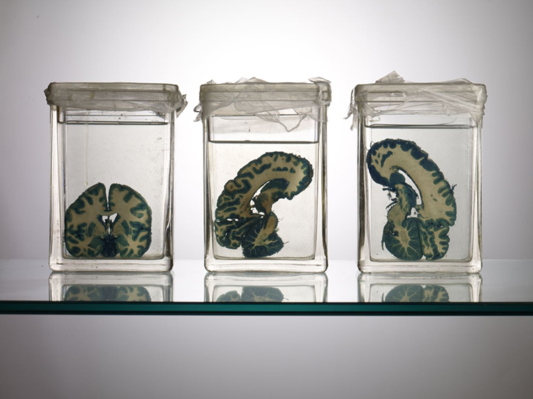 Amazing Photographs Of A Giant, Forgotten Collection Of Human Brains ...