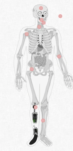 The Human Bionic Project: A Data Repository For Inspector Gadget Body ...