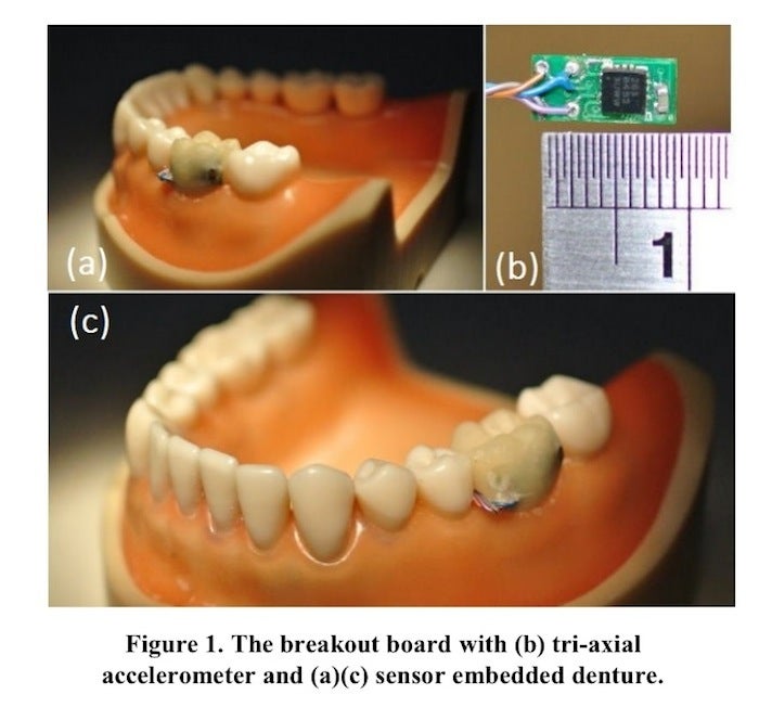 This Tooth Sensor Puts Wearable Computing In Your Mouth - Fast Company