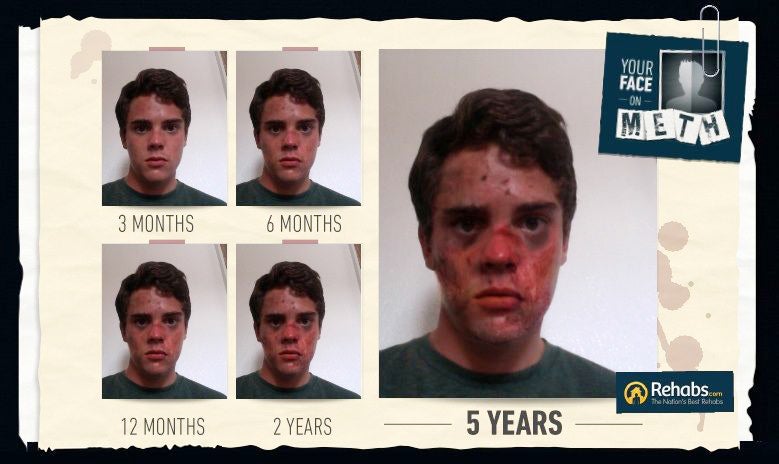 See What You'd Look Like As A Meth Addict - Fast Company