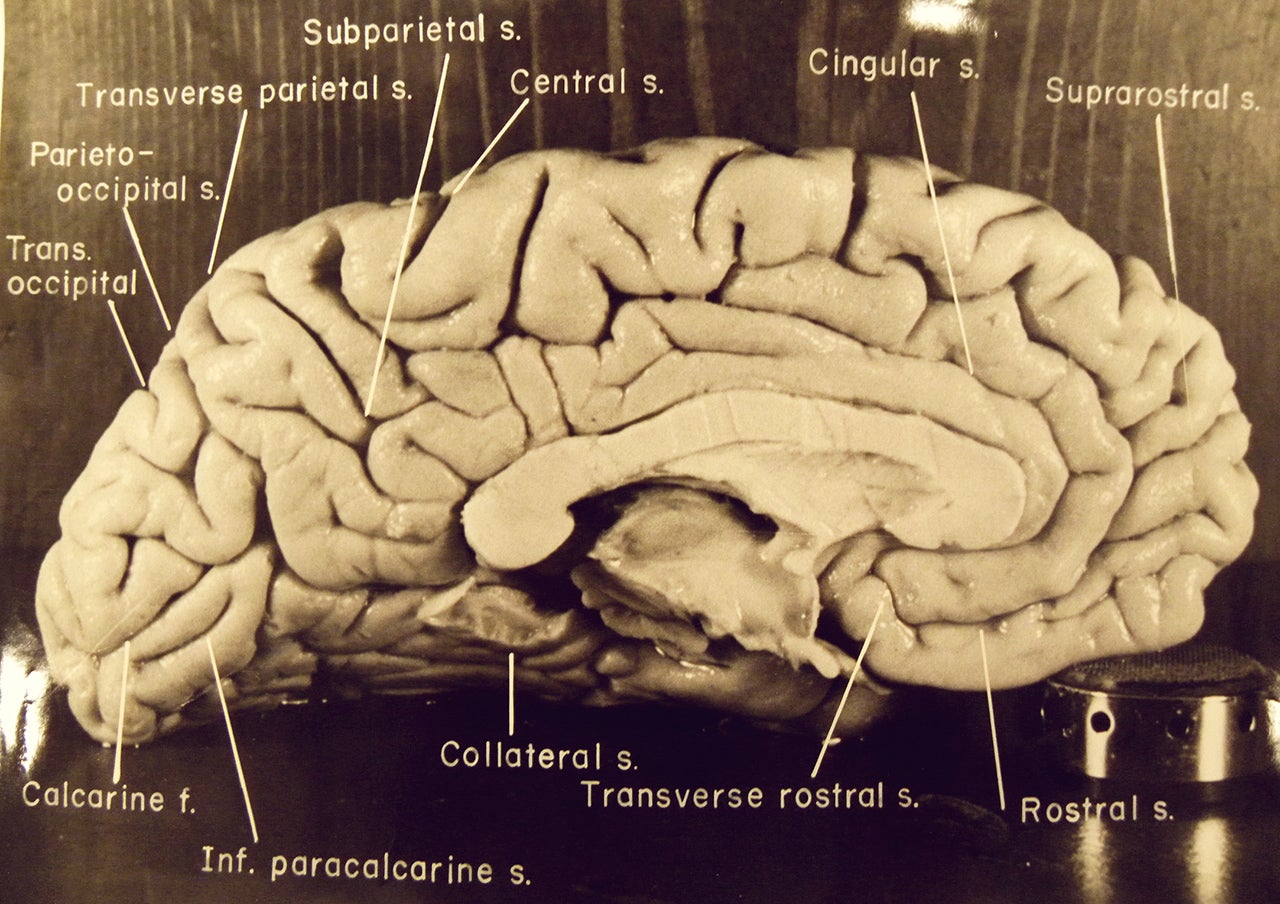 How Einstein's Brain Was Probably Different Than Yours, And Why He Was ...
