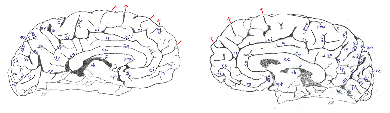 How Einstein's Brain Was Probably Different Than Yours, And Why He Was ...