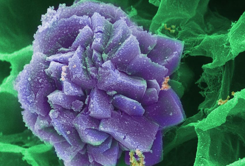 Pot Looks Psychedelic Under The Microscope, Dude - Fast Company