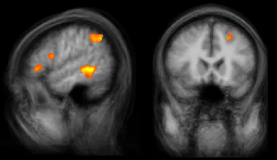 This Is Your Brain On Code, According To Functional MRI Imaging - Fast ...