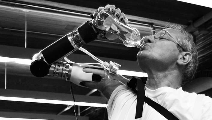 Segway Inventor Creates Revolutionary Mind-Controlled Prosthetic Arm ...