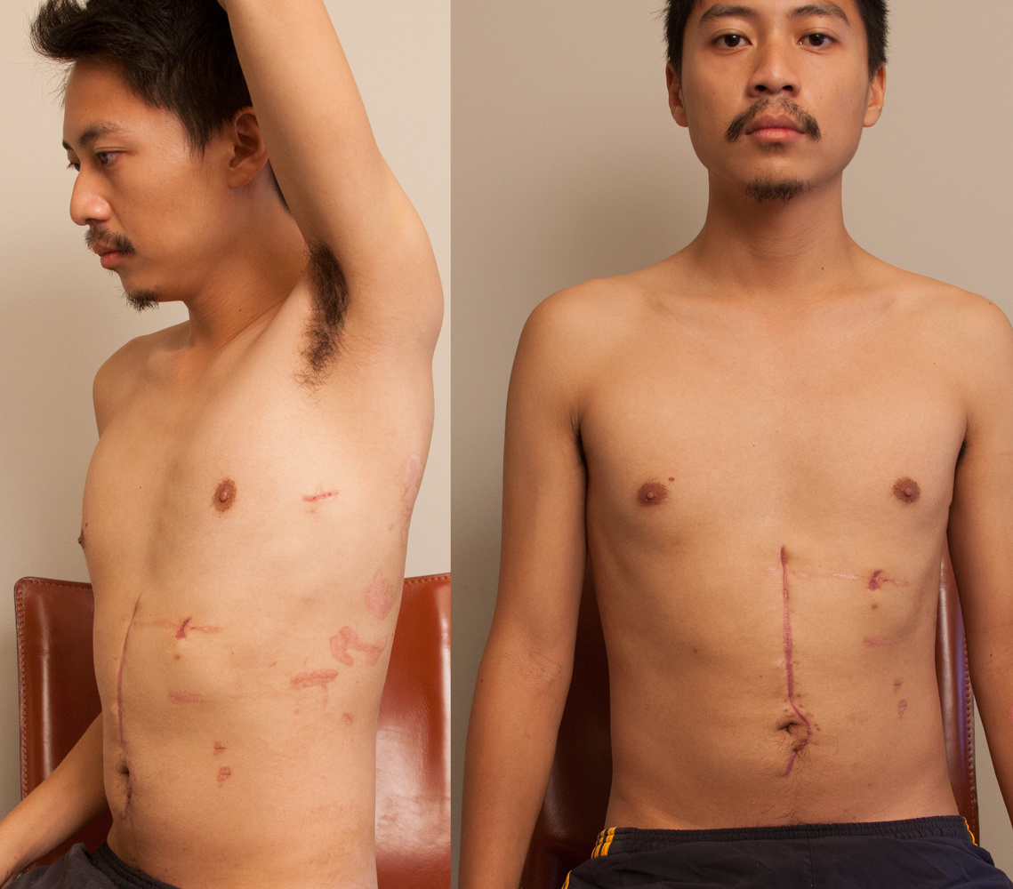 Gunshot Victim Takes A Selfie A Day To Document His Healing - Fast Company