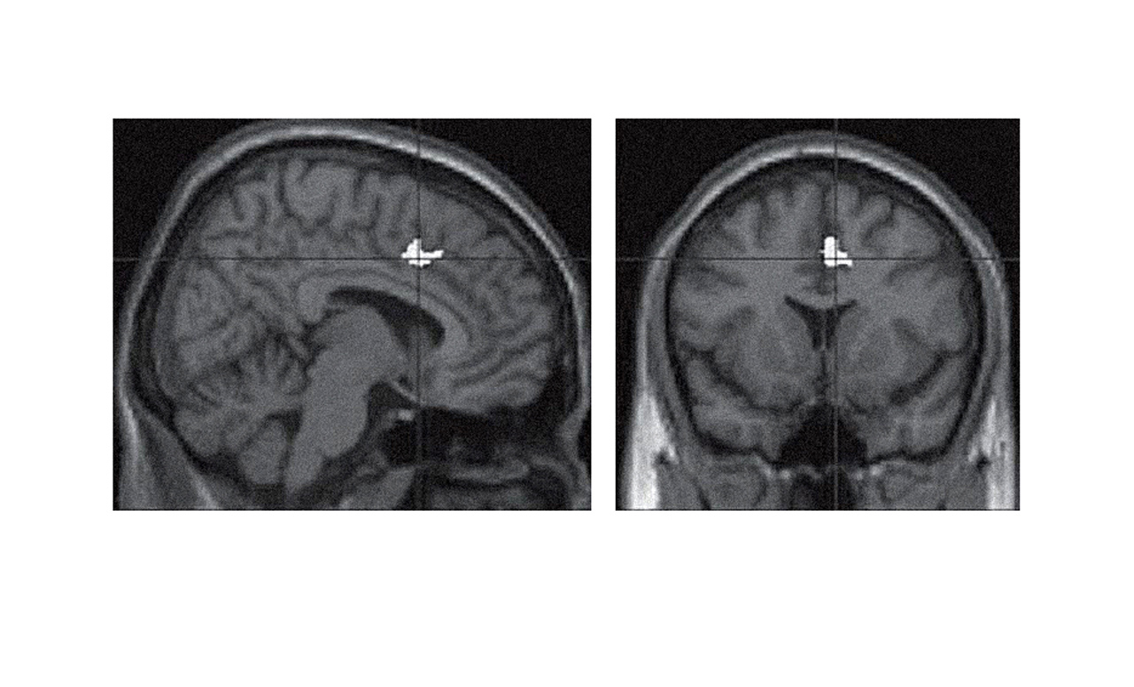 The Neuroscience Of "Harry Potter" - Fast Company