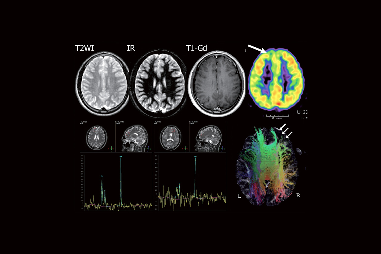 New Technology Helps Surgeons Better Map The Brain - Fast Company