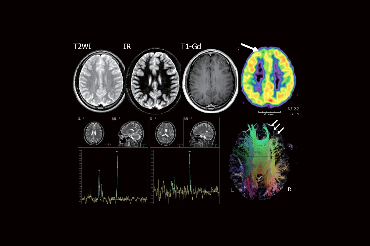 New Technology Helps Surgeons Better Map The Brain - Fast Company