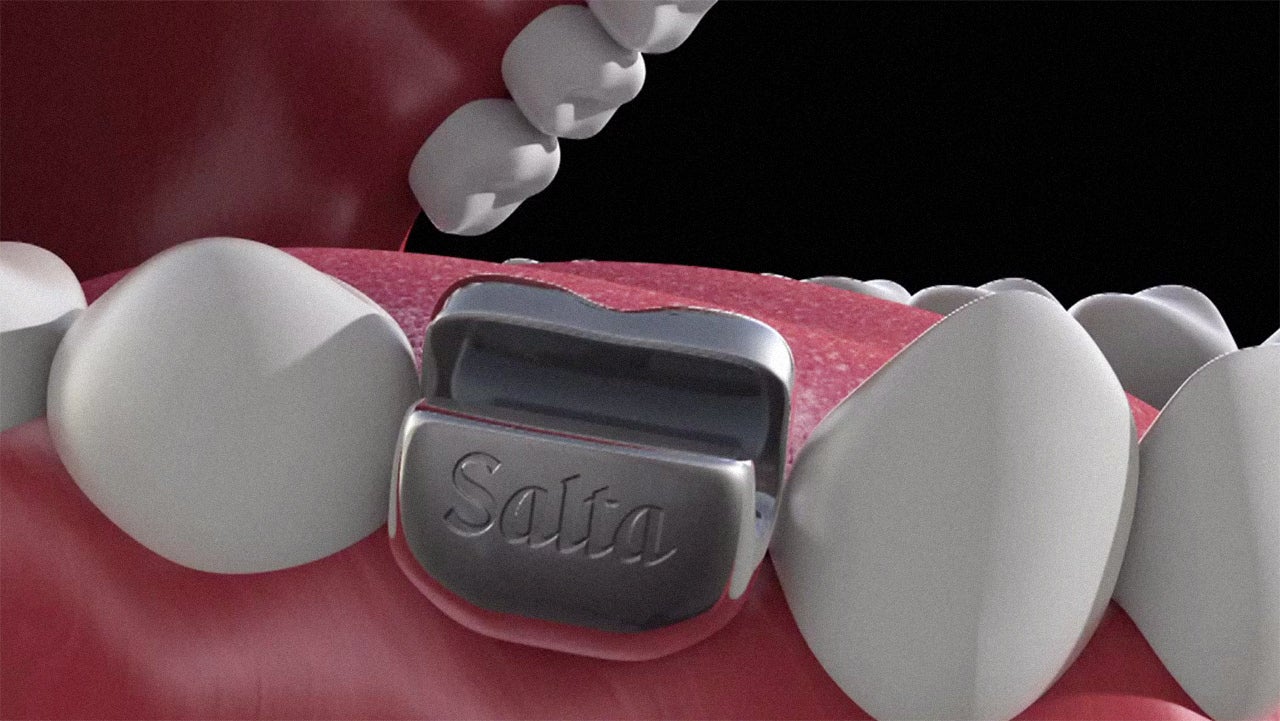 A Beer Brand Replaced Rugby Players' Missing Teeth With Implanted ...