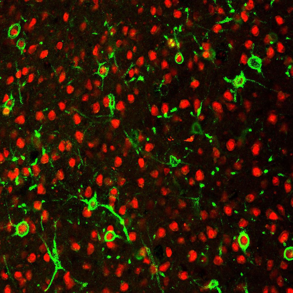 Can Exercise Really Make You Grow New Brain Cells? - Fast Company