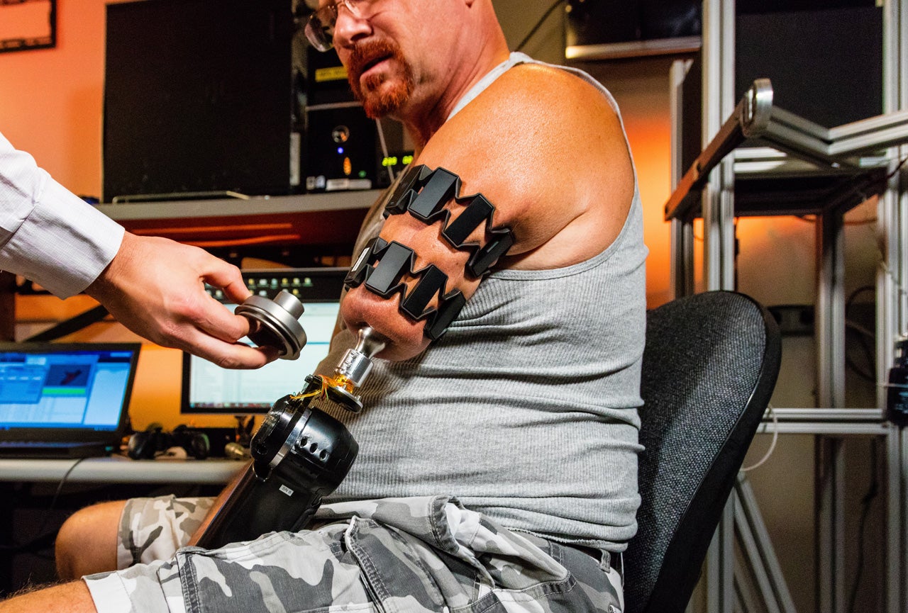 This High-Tech Prosthetic Works With A Game-Controller Sold On Amazon ...