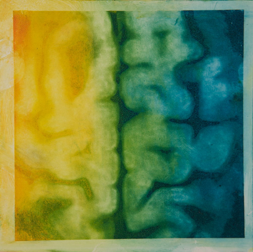 Diagnosed With Multiple Sclerosis, An Artist Turns Her MRIs Into Art ...