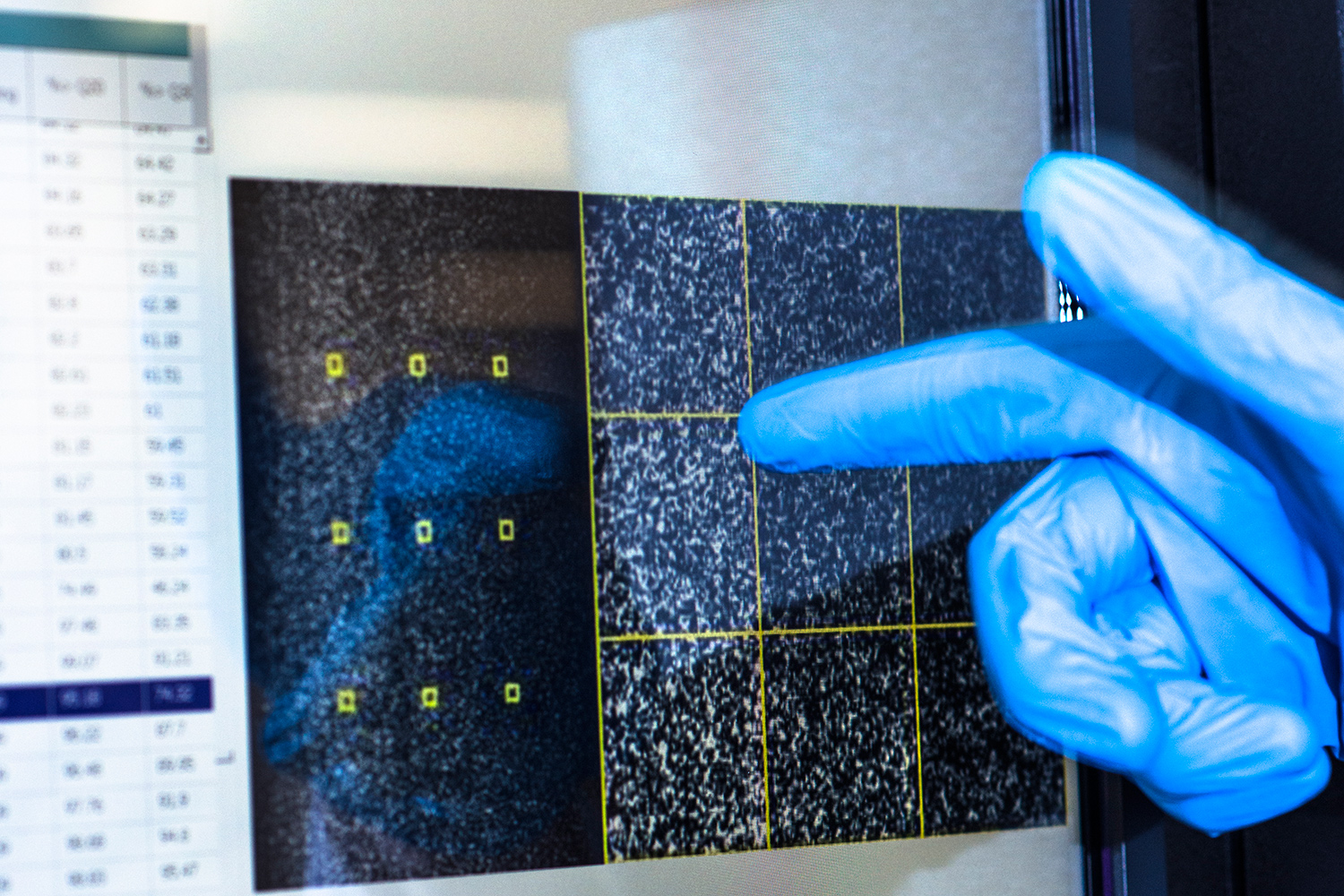 Illumina, Secret Giant Of DNA Sequencing, Is Bringing Its Tech To The ...