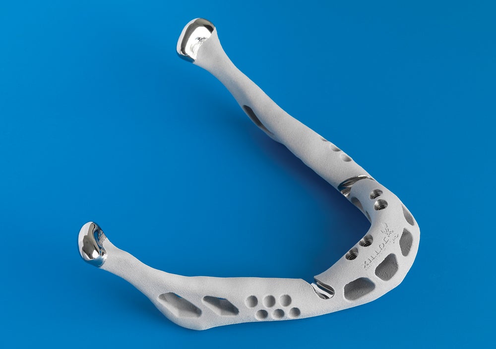 Why The World's First 3-D Printed Jaw Is Really No Big Deal - Fast Company