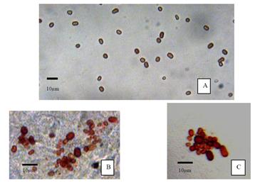 E.T. For Real: Cells From Red Rain Can Reproduce, May Be From "Out ...
