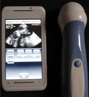 Ultrasound Scans of Your Baby Now Available Via Smartphone - Fast Company