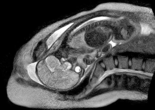 Baby Born Inside an MRI Machine, Captured in Breakthrough Imagery ...