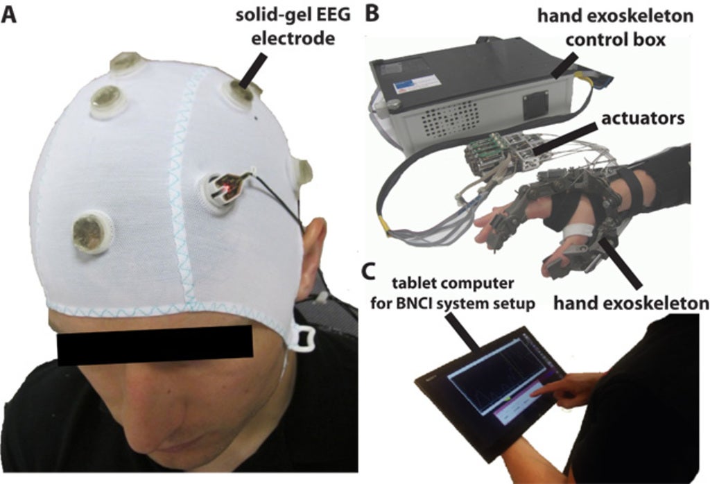 This brain-controlled robotic hand could help people with certain types ...