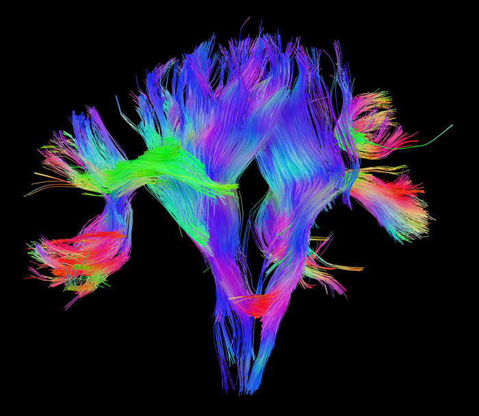 8 Mind-Blowing Images Of The Brain At Work - Fast Company