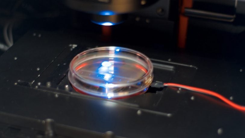 This Human Heart-On-A-Chip Lets Us Test Drugs On Actual Human Tissue ...