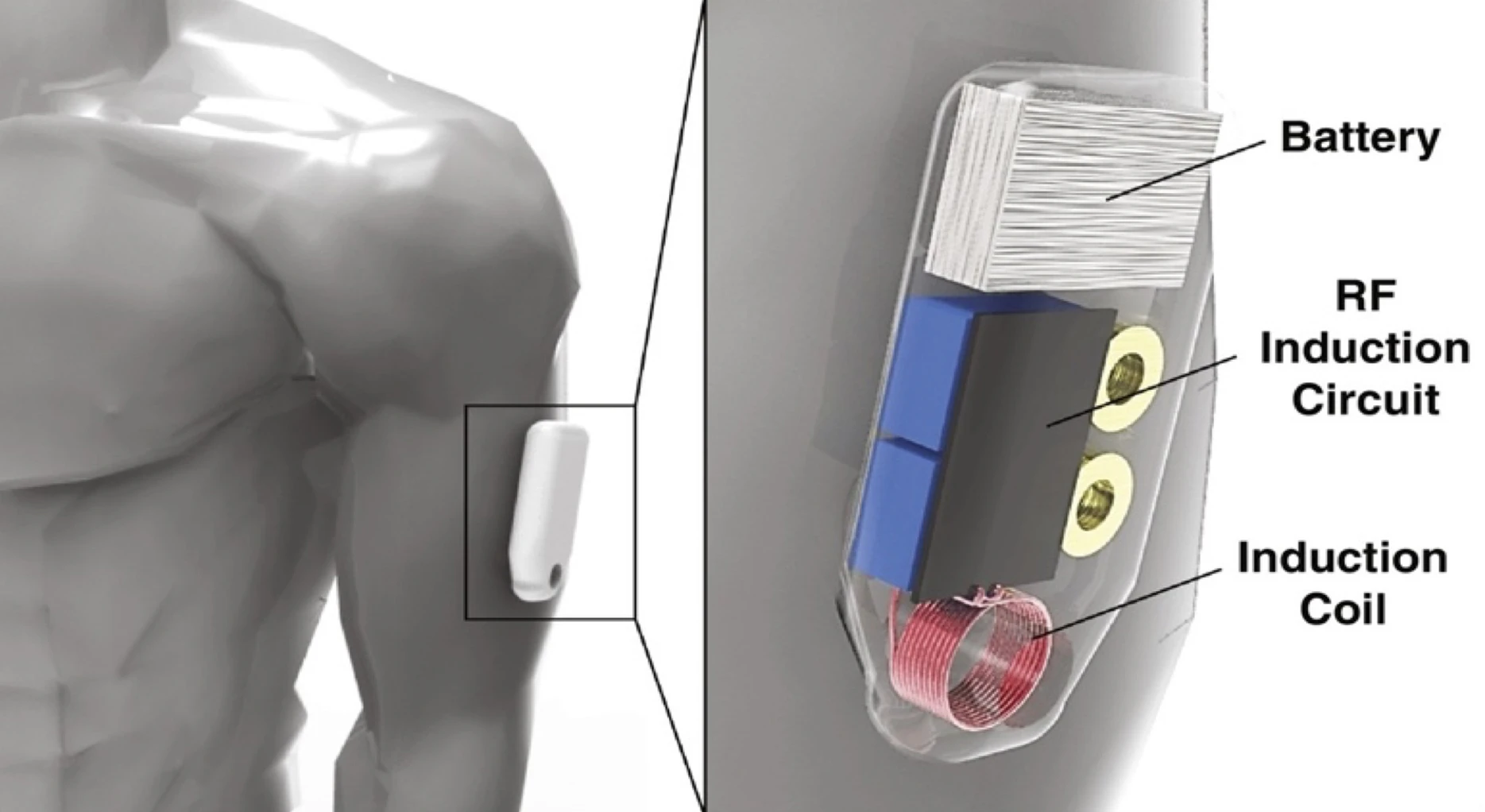 This revolutionary device would automatically reverse opioid overdoses ...