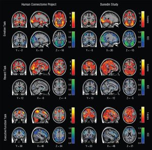 Duke University researchers say every brain activity study you've ever ...