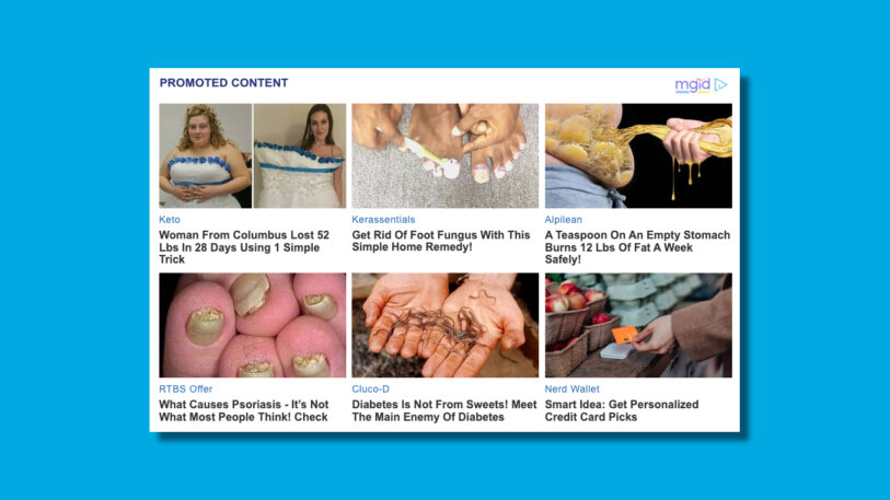 The chumbox is still the dirty design secret of the internet