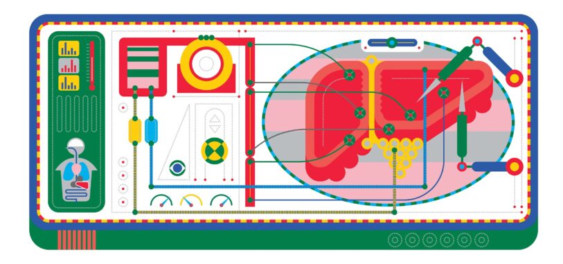 The LifePort Liver Transporter treats the donor organ like a patient