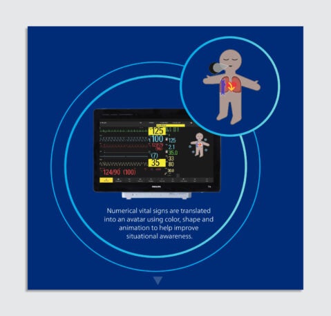 Philips partnered with anesthesiologists to redesign the patient monitor