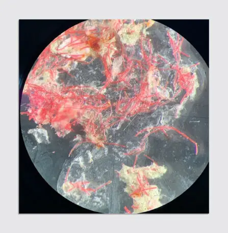 Laundry causes microplastic pollution: How to wash clothes sustainably